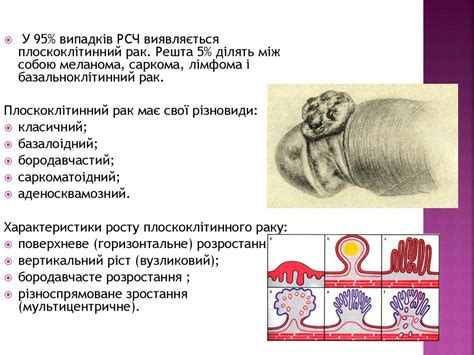 урологія - online presentation