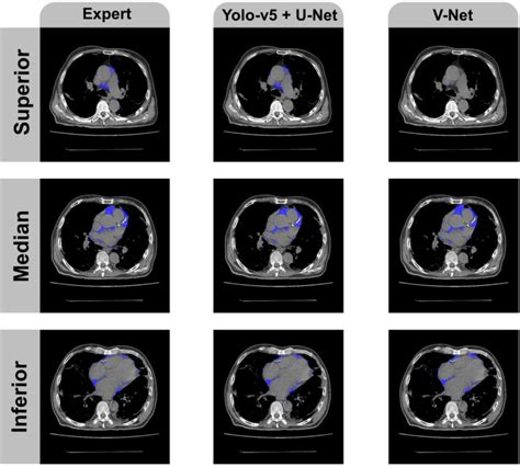 flowchart of heart contour segmentation data processing download