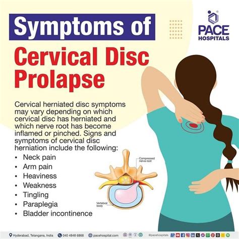 Degenerative Disc Cervical Symptoms