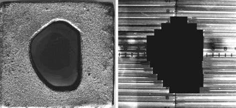 Conformal Therapy And Intensity Modulated Radiation Therapy Treatment Planning Treatment