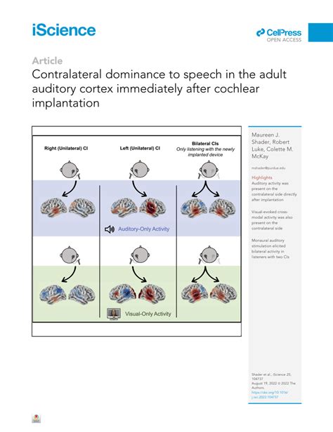 Pdf Contralateral Dominance To Speech In The Adult Auditory Cortex Immediately After Cochlear