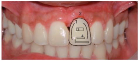 Shows The Variable For Wes Assessment Download Scientific Diagram