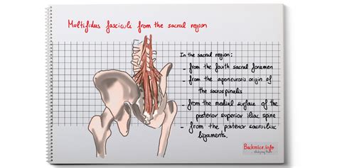 Multifidus Triangle Syndrome
