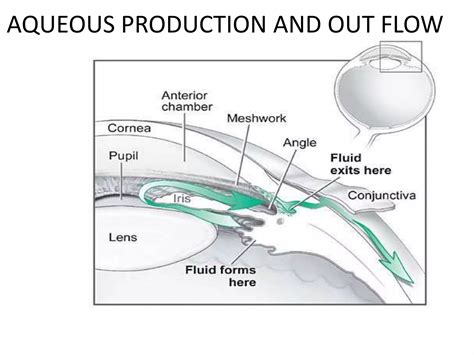 Inflamatory Glaucoma Ppt