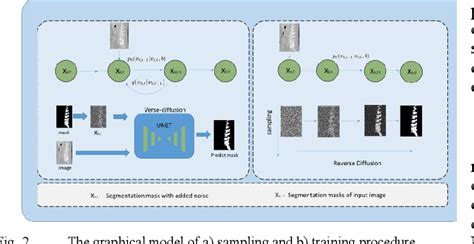 Introducing Shape Prior Module In Diffusion Model For Medical Image