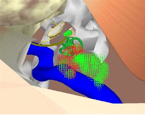 Visualization Of Removed Voxel Visibility In This Simulation The Download Scientific Diagram