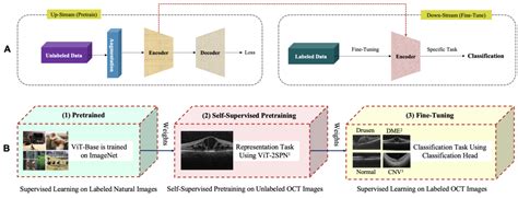 논문 리뷰 Vit 2spn Vision Transformer Based Dual Stream Self Supervised Pretraining Networks For
