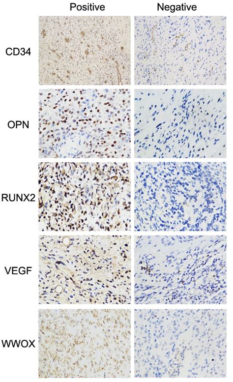 Representative Immunohistochemical Staining Of Wwox Vegf Runx2 Opn