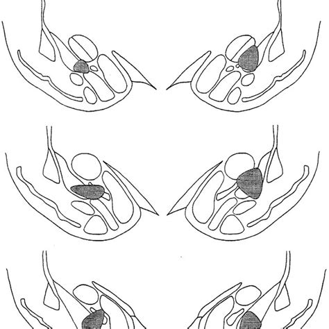 Rostral Caudal Extent Of The Amygdala In A Representative Hamster Ž Download Scientific