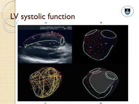 PPT Echo LV Function Assessment PowerPoint Presentation Free Download ID 6595619