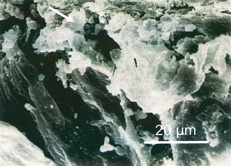 Sem Micrograph Showing Secretion Of Bone Matrix In Rings Lamellae