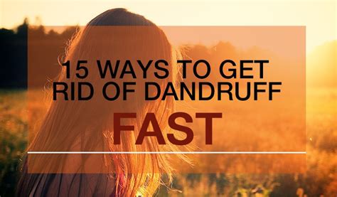 15 Ways To Get Rid Of Dandruff Fast Dandruff Deconstructed