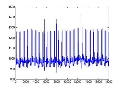 Detection Of Qrs Complexes In Ecg Signals Based On Empirical Mode Decomposition