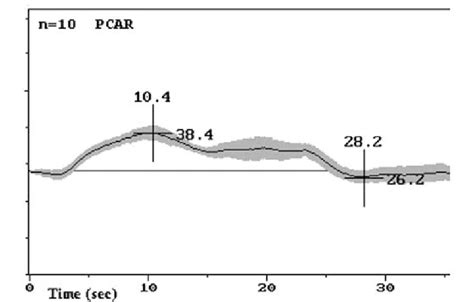 Averaged Responses Of 10 Cycles Recorded In The P2 Segment Of The PCA Download Scientific