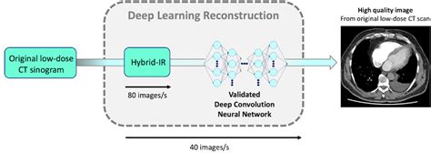 Figure 1 From Deep Learning Versus Iterative Reconstruction For Ct Pulmonary Angiography In The