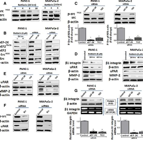 The Effect Of Eukaryotic Elongation Factor 2 Kinase EEF 2K Download Scientific Diagram