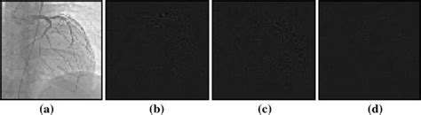 Dwt Subband Images A Aproximation B Horizontal C Vertical D