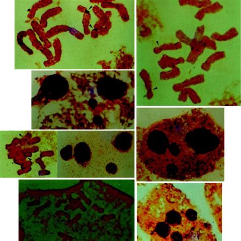Mitotic Metaphases And Maximum Number Of Nucleoli In Interphase Cells Download Scientific
