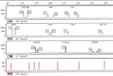 Electropherogram Of Dna Extracted From The 12 Year Old Bone Sample Download Scientific Diagram