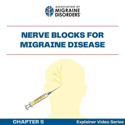 Chapter Episode Nerve Blocks For Migraine Disease Association Of Migraine Disorders