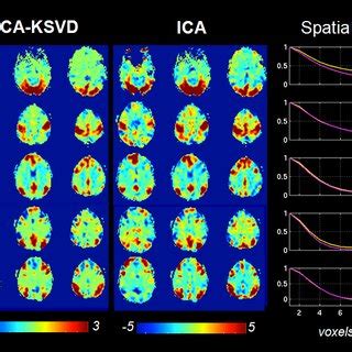 Resting State FMRI Experiment Consistent Resting State Networks Download Scientific Diagram