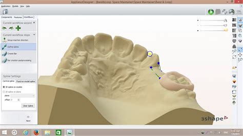 Digital Band Loop Space Maintainer Design YouTube