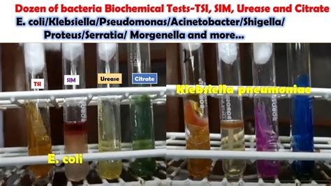 Biochemical Test Of Klebsiella Oxytoca Biochemical Test Of Bacteria My Xxx Hot Girl