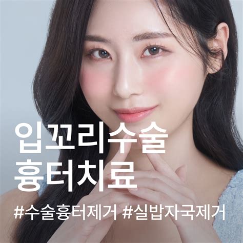 입꼬리입술라인 수술 흉터 할인 가격 후기 전후 효과 정보 By 명옥헌한의원 여신티켓 국내 1등 피부과 성형외과 플랫폼