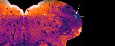 Neuroscientists Have Discovered A Previously Hidden Region In The Human Brain Sciencealert
