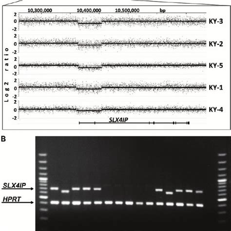 Deletion Of The First Two Exons Of Slx4ip On Chromosome 20 In Five Download Scientific Diagram