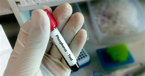 What Is Hyperphosphatemia