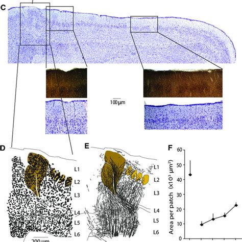 Identified Neurons From The Deep Layers Of Medial Entorhinal Cortex A Download Scientific