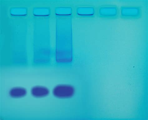 Mini Prep Isolation Of Plasmid DNA BioTek
