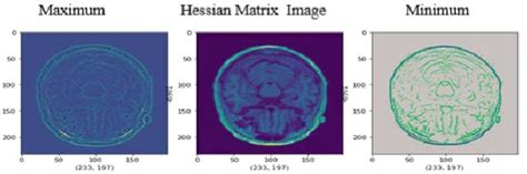Hessian Metrix Of Ahs Images Download Scientific Diagram