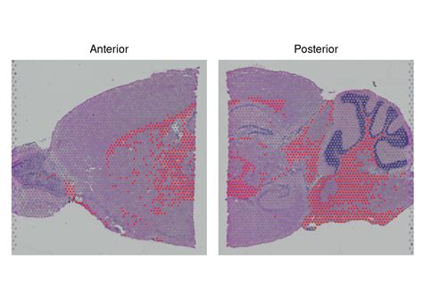 Marker Gene Identification Spatial Transcriptomics