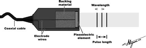 Ultrasound Radiology Key