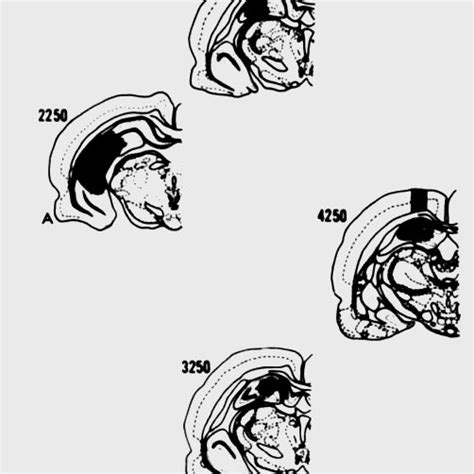 Diagrams Of The Limits Of The Injection Of Retrograde Tracers Made In Download Scientific