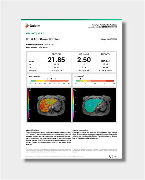 Personalized Liver Segmentation Based On Ai Qp Liver®