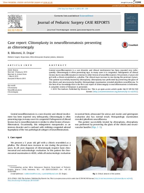 Pdf Case Report Clitoroplasty In Neurofibromatosis Presenting As