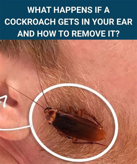 Sheshines What Really Happens If A Cockroach Crawls Into Your Ear It