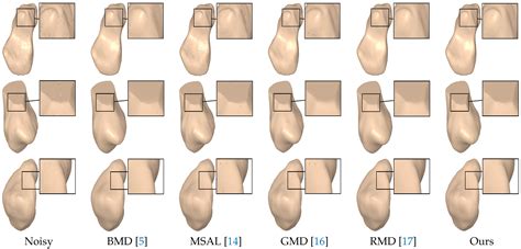 German Cut Circumcision