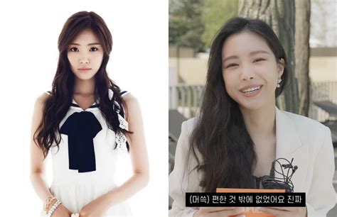 Fans Think That Apink Naeuns Face Looks Worse After Plastic Surgery