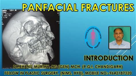 Panfacial Fractures Drm Bhanumurthy Vaishnavi Super Speciality