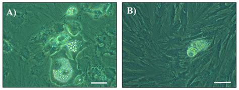 Hygiene Of Housing Conditions And Proinflammatory Signals Alter Gene Expressions In Porcine