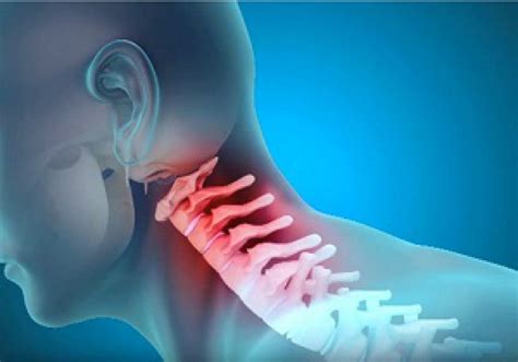 Основные причины развития лордоза шейного отдела позвоночника лечение и полезная информация для