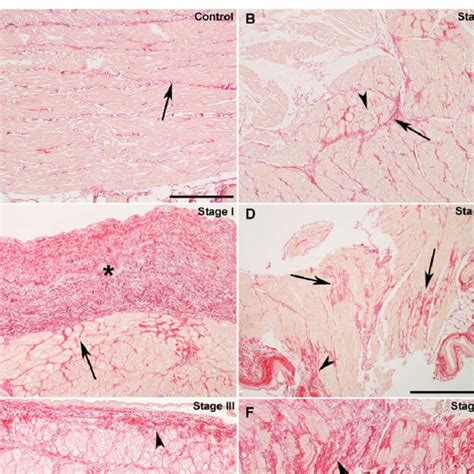 Fibroblast And Myofibroblast Quantification A The Density Of Download Scientific Diagram