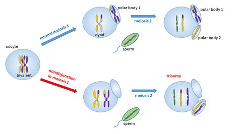 Nondisjunction Turner Syndrome