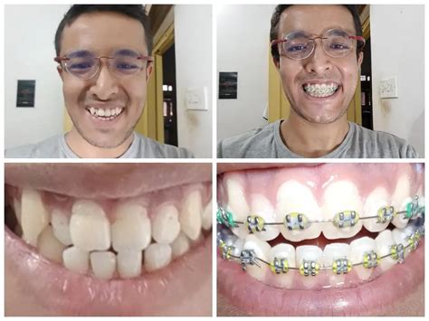 One Month Progress Scrolller