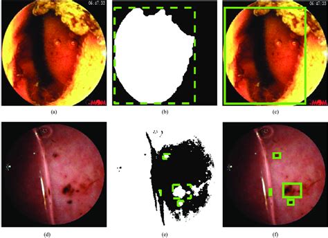 Illustrations Of Salient Region Segmentation Based Region Proposal Download Scientific Diagram