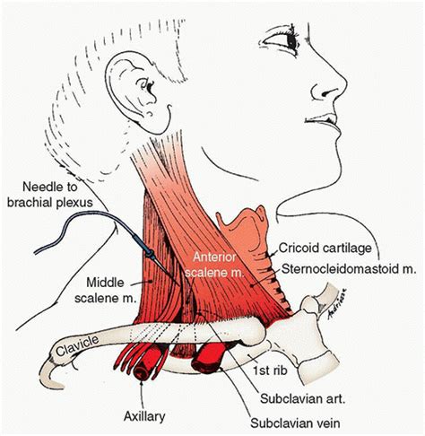 Interscalene Brachial Plexus Block